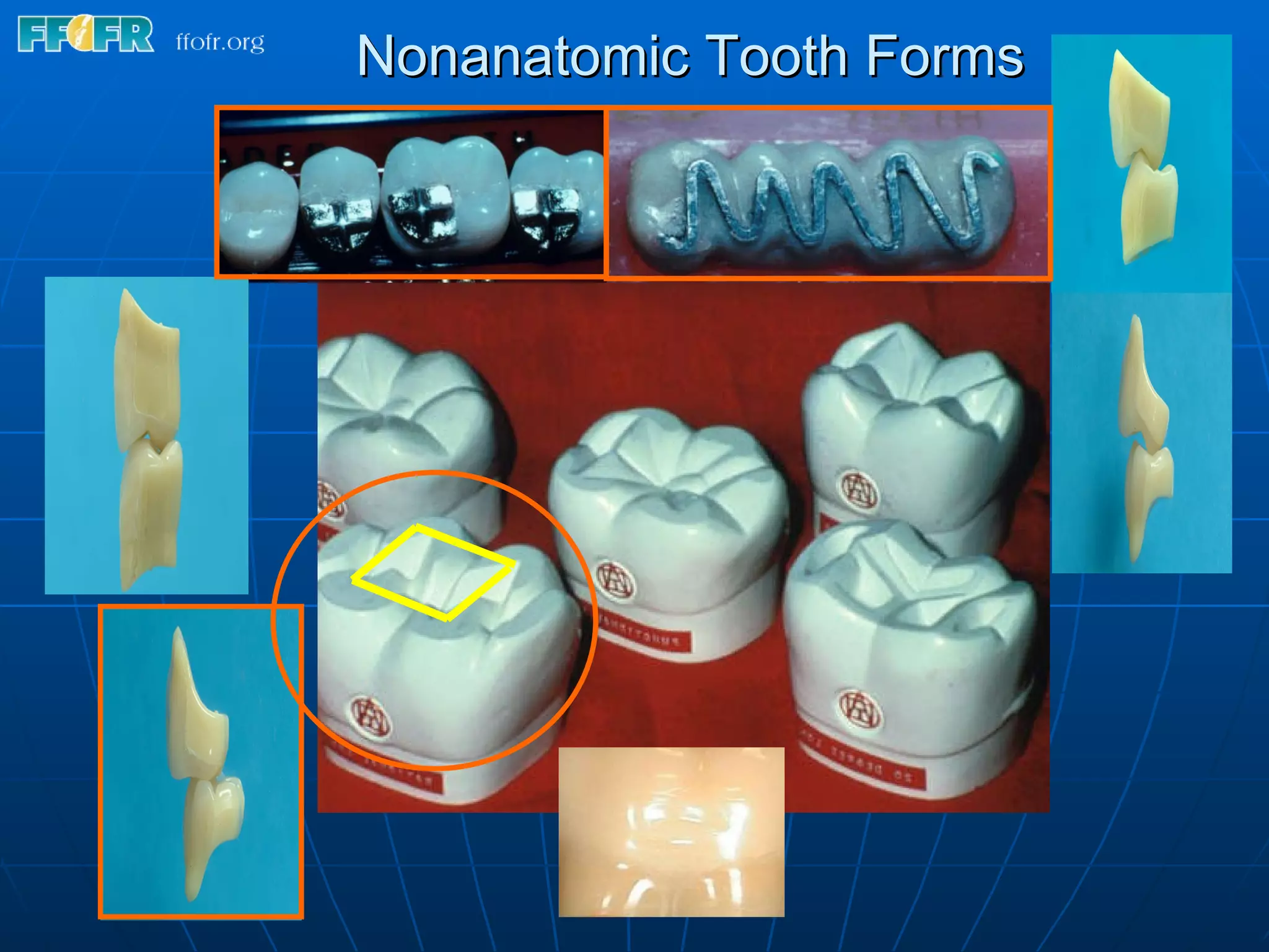 15.concepts of complete denture occlusion | PPT