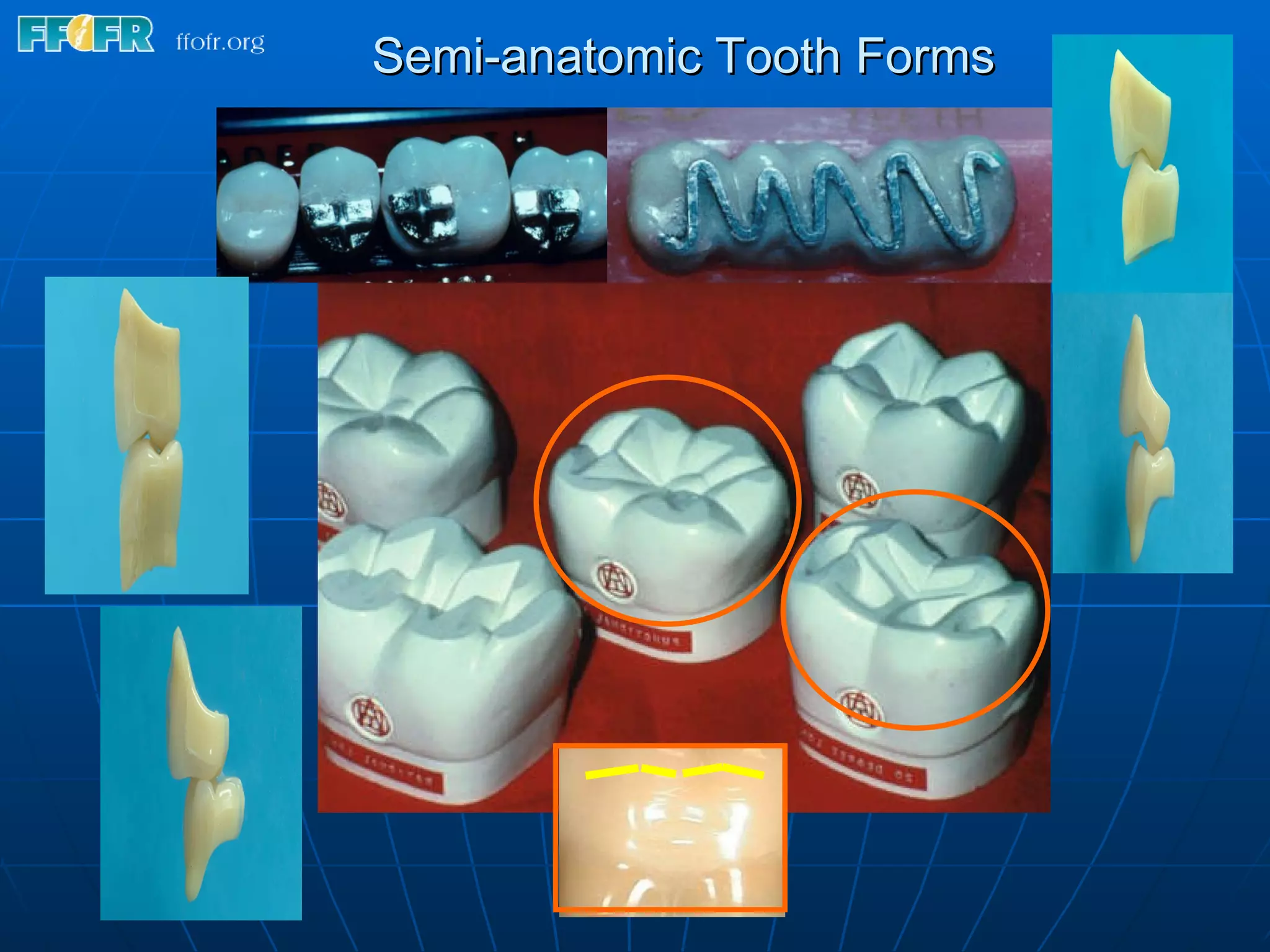 15.concepts of complete denture occlusion | PPT