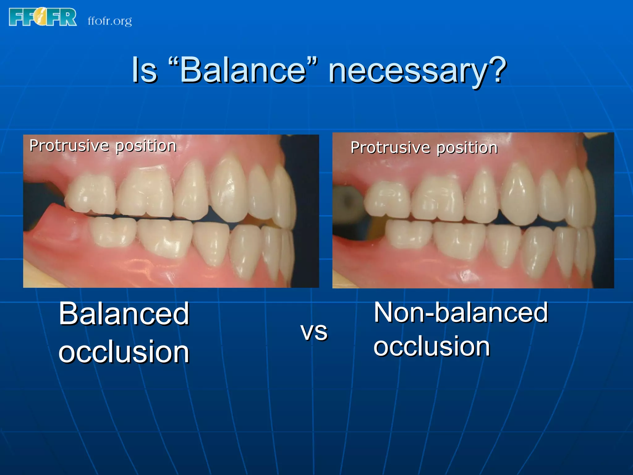 15.concepts of complete denture occlusion | PPT