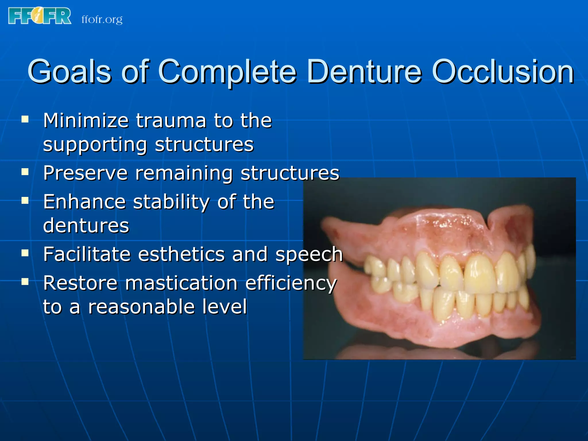 15.concepts of complete denture occlusion | PPT