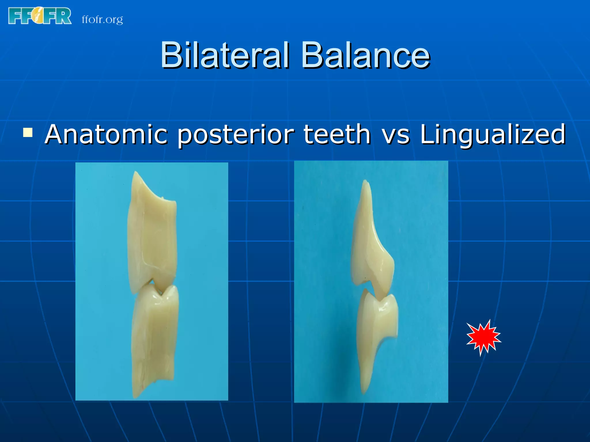 15.concepts of complete denture occlusion | PPT