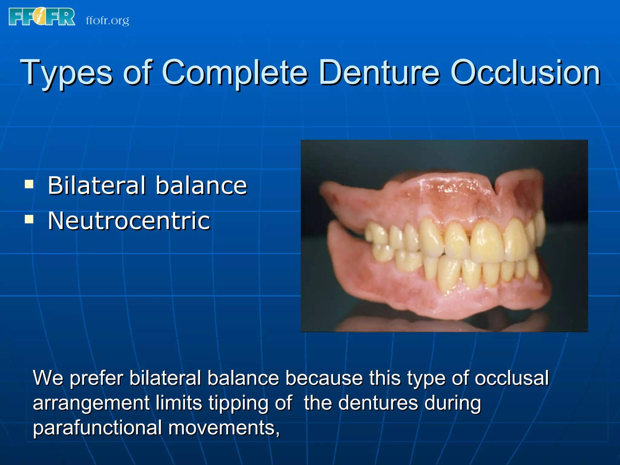 15.concepts of complete denture occlusion | PPT