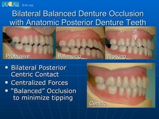 15.concepts of complete denture occlusion | PPT