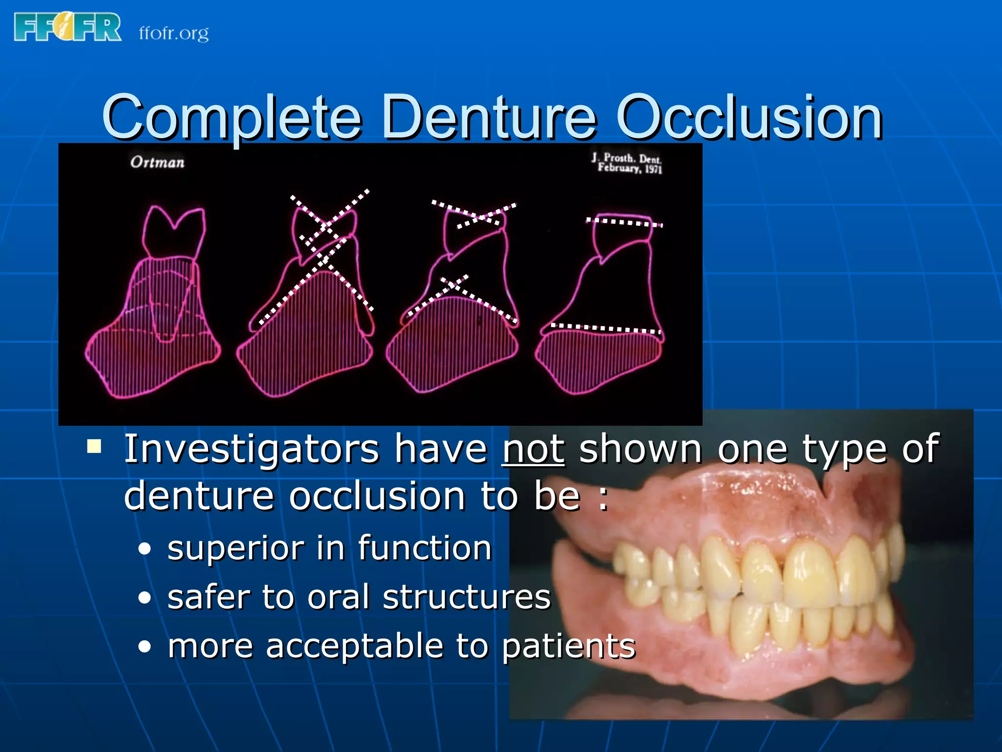 15.concepts of complete denture occlusion | PPT