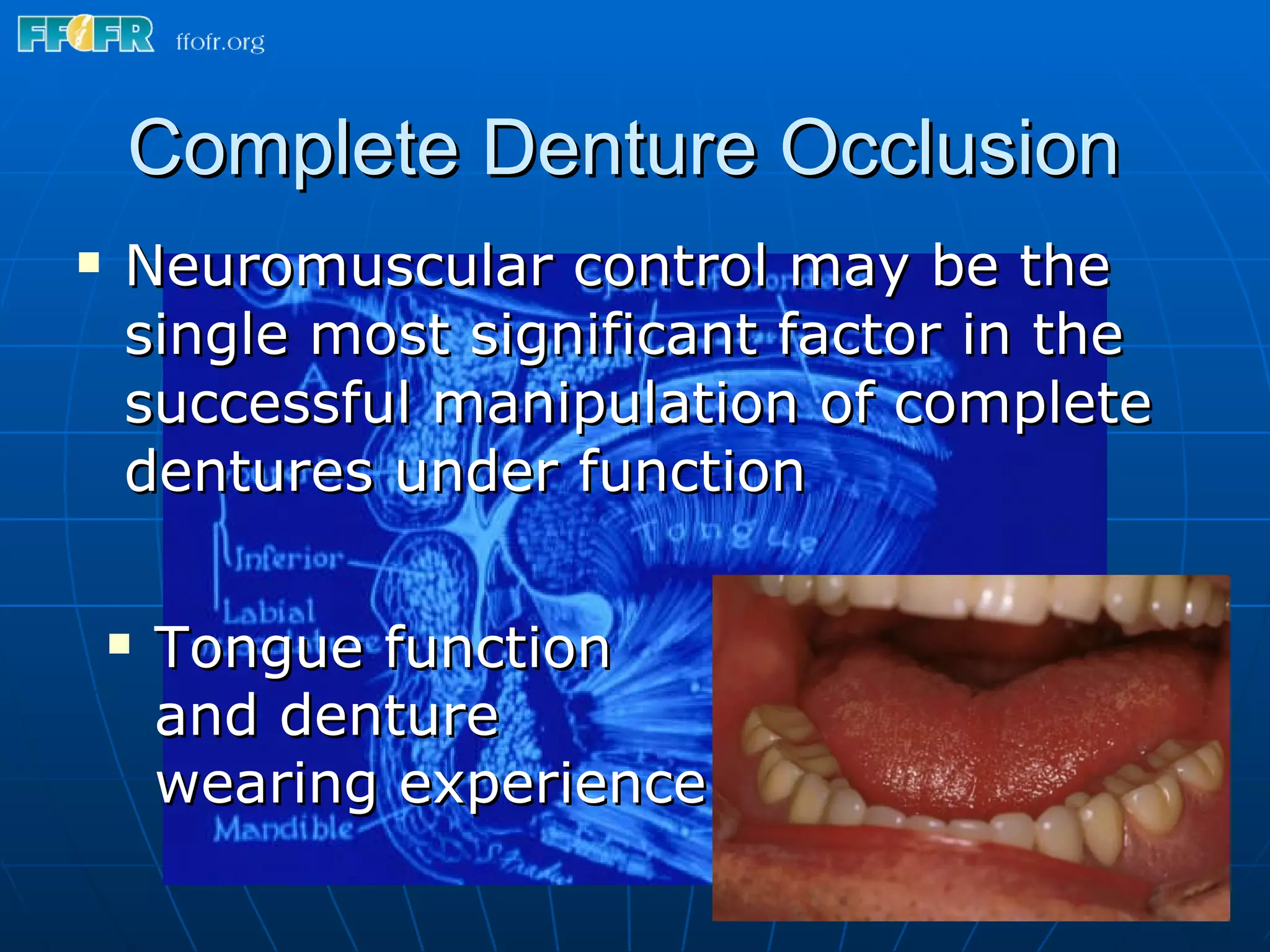 15.concepts of complete denture occlusion | PPT