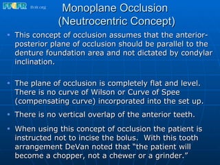 15.concepts of complete denture occlusion | PPT