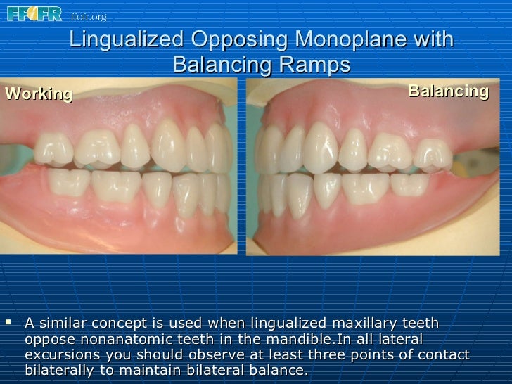 15.concepts of complete denture occlusion