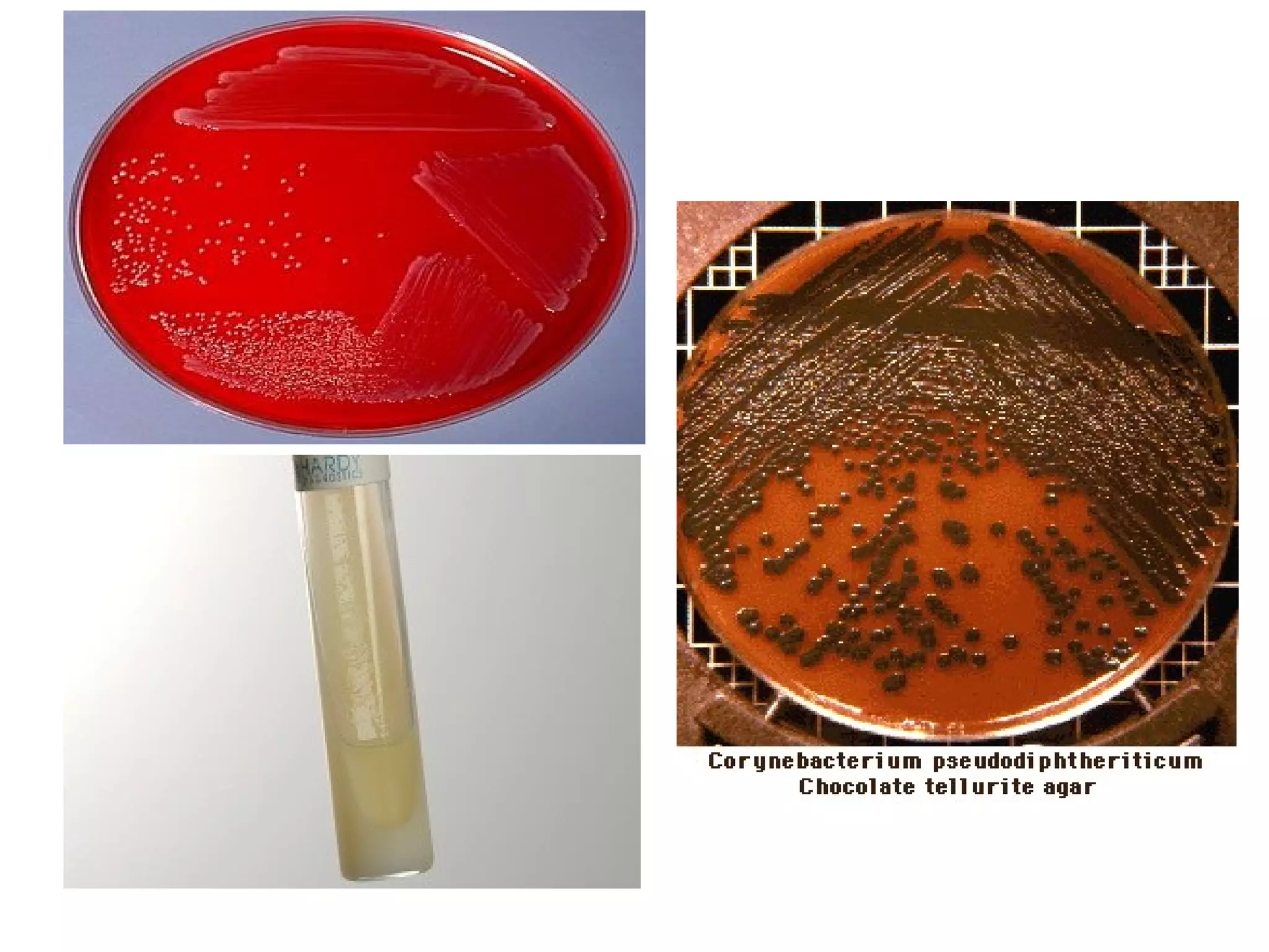15 corynebacterium diphtheriae | PPT