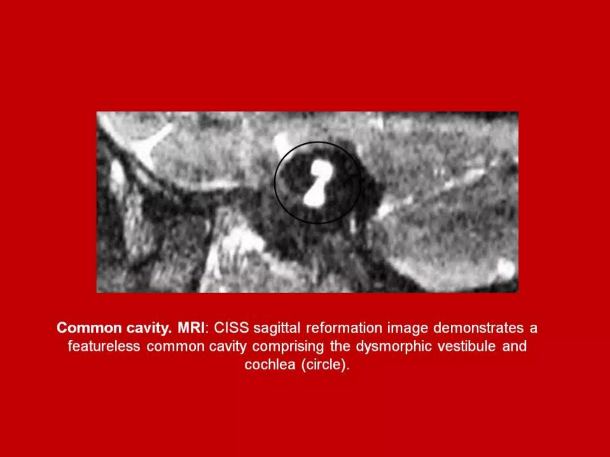 15-Dr Ahmed Esawy imaging oral board of sinus ,ear,fascial nerve ...