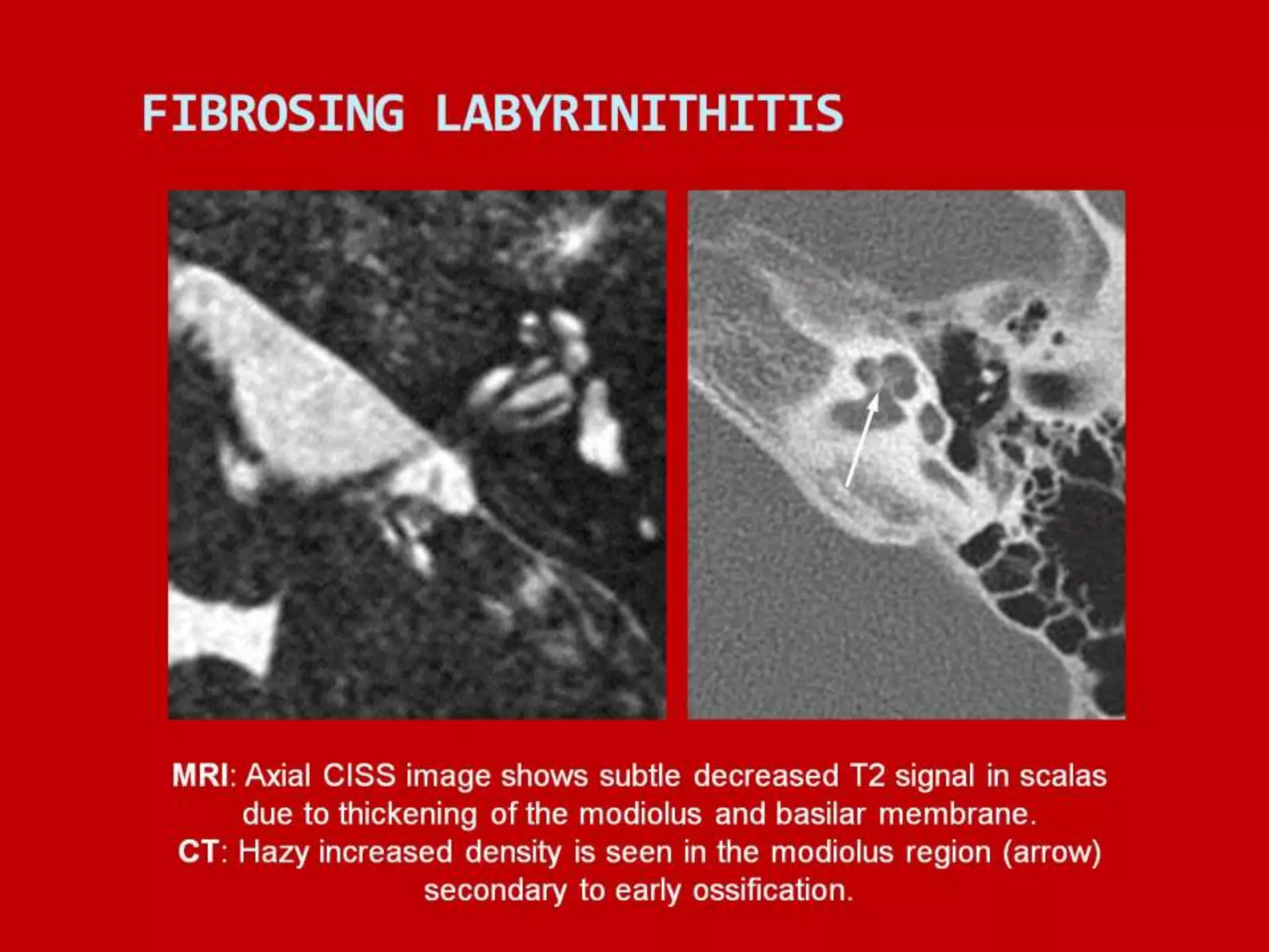 15-Dr Ahmed Esawy imaging oral board of sinus ,ear,fascial nerve ...