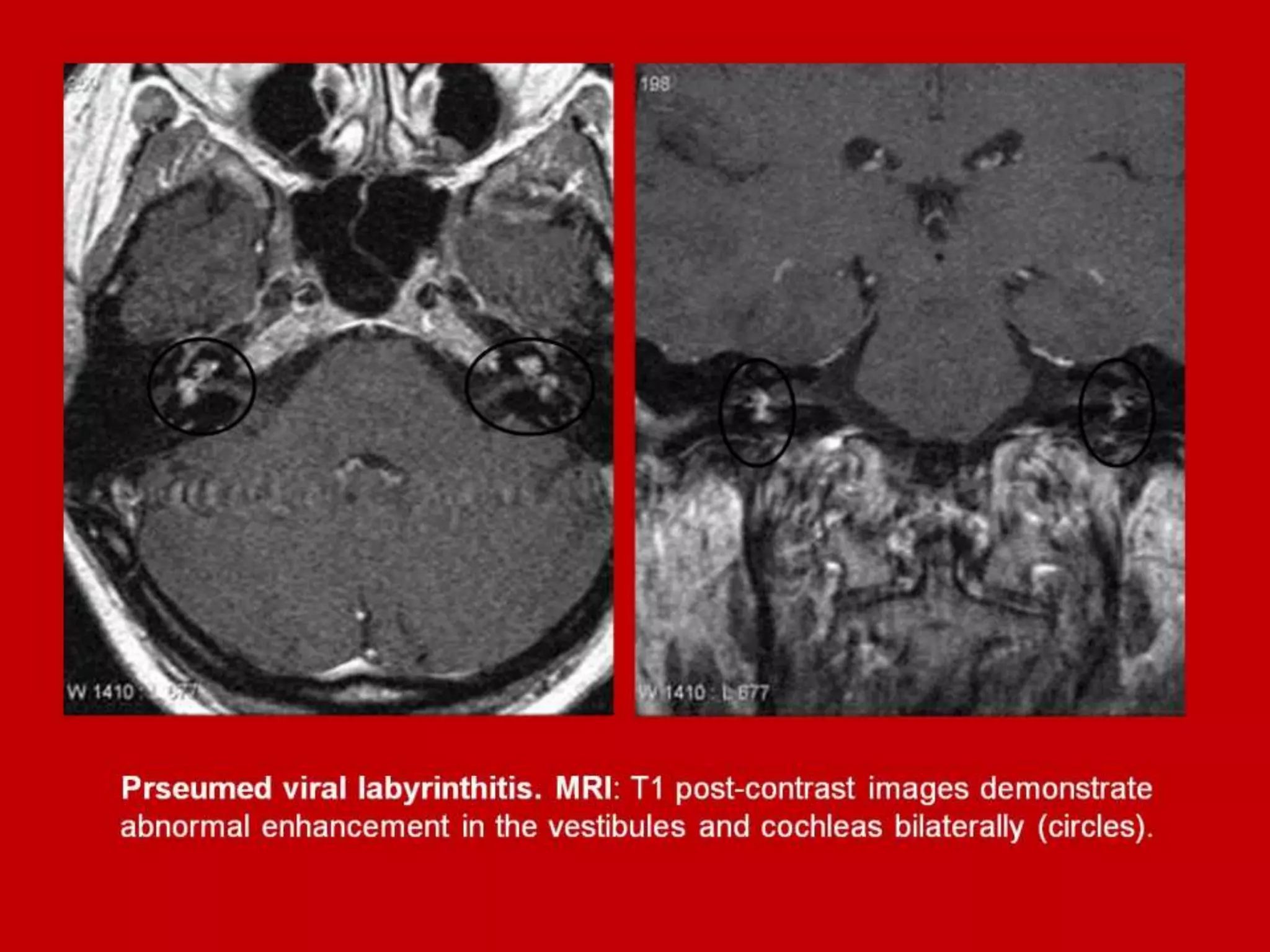 15-Dr Ahmed Esawy imaging oral board of sinus ,ear,fascial nerve ...