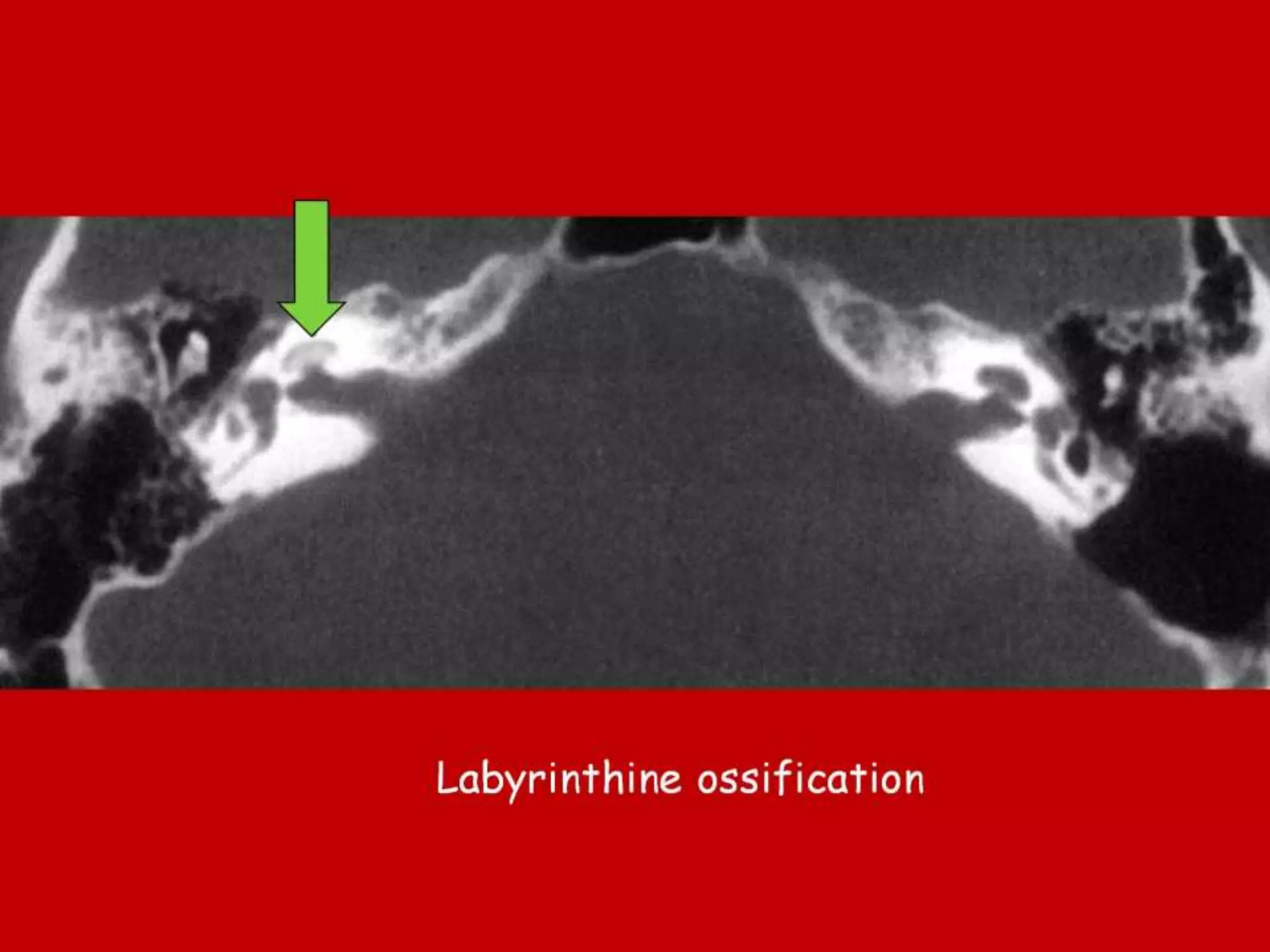 15-Dr Ahmed Esawy imaging oral board of sinus ,ear,fascial nerve ...