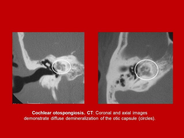 15-Dr Ahmed Esawy imaging oral board of sinus ,ear,fascial nerve ...
