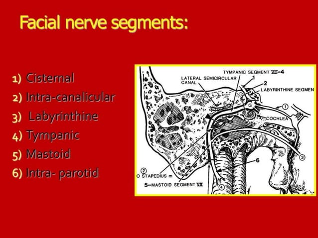 15-Dr Ahmed Esawy imaging oral board of sinus ,ear,fascial nerve ...