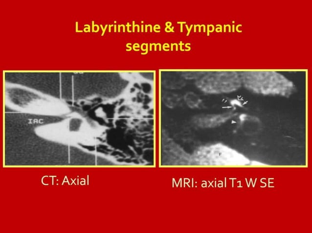 15-Dr Ahmed Esawy imaging oral board of sinus ,ear,fascial nerve ...