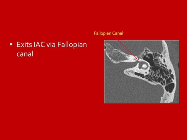 15-Dr Ahmed Esawy imaging oral board of sinus ,ear,fascial nerve ...