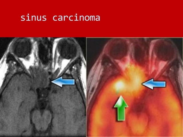 15-Dr Ahmed Esawy imaging oral board of sinus ,ear,fascial nerve ...