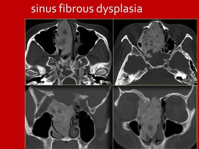 15-Dr Ahmed Esawy imaging oral board of sinus ,ear,fascial nerve ...
