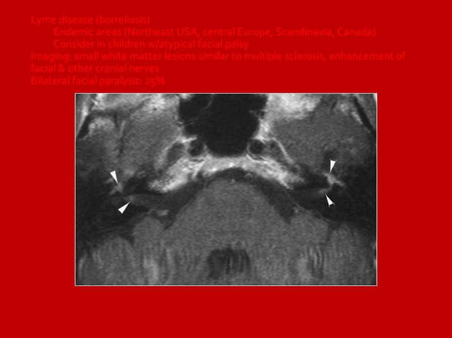 15-Dr Ahmed Esawy imaging oral board of sinus ,ear,fascial nerve ...
