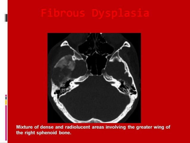 15-Dr Ahmed Esawy imaging oral board of sinus ,ear,fascial nerve ...