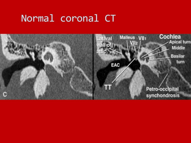 15-Dr Ahmed Esawy imaging oral board of sinus ,ear,fascial nerve ...