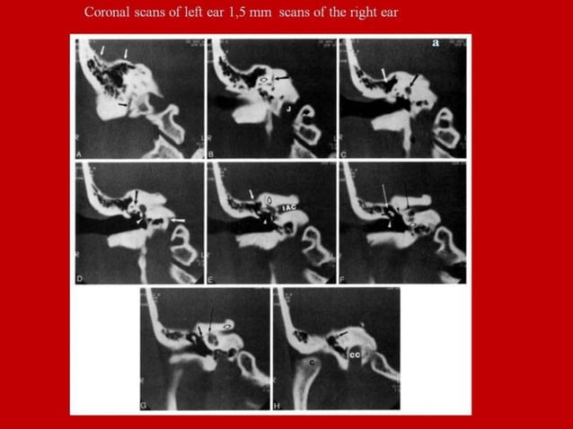 15-Dr Ahmed Esawy imaging oral board of sinus ,ear,fascial nerve ...