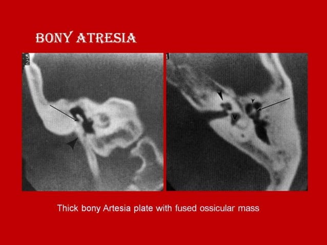 15-Dr Ahmed Esawy imaging oral board of sinus ,ear,fascial nerve ...