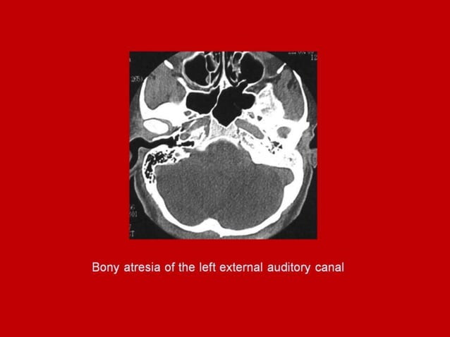 15-Dr Ahmed Esawy imaging oral board of sinus ,ear,fascial nerve ...