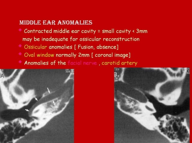15-Dr Ahmed Esawy imaging oral board of sinus ,ear,fascial nerve ...