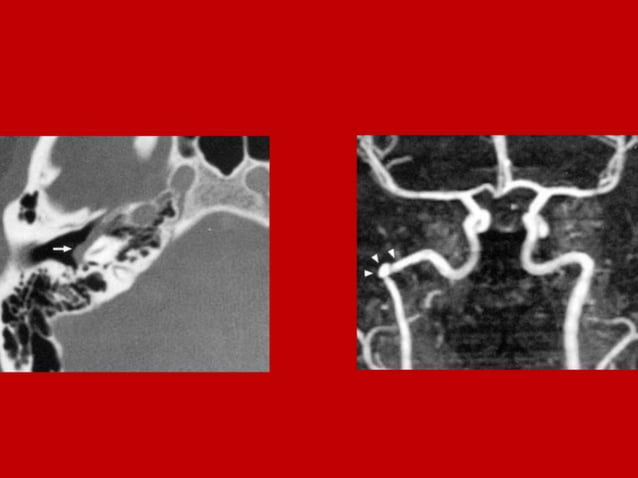 15-Dr Ahmed Esawy imaging oral board of sinus ,ear,fascial nerve ...