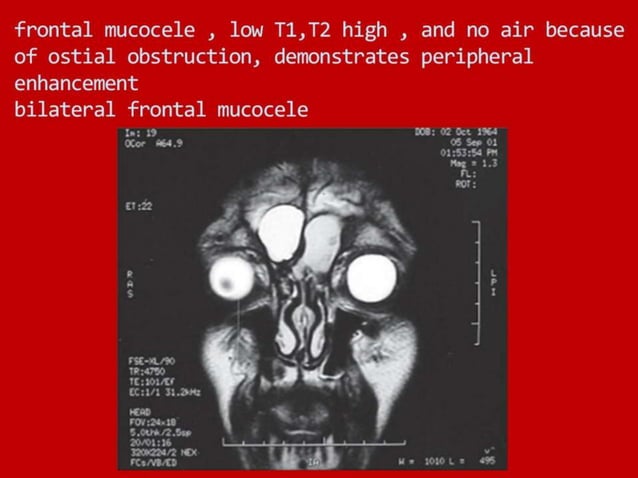 15-Dr Ahmed Esawy imaging oral board of sinus ,ear,fascial nerve ...