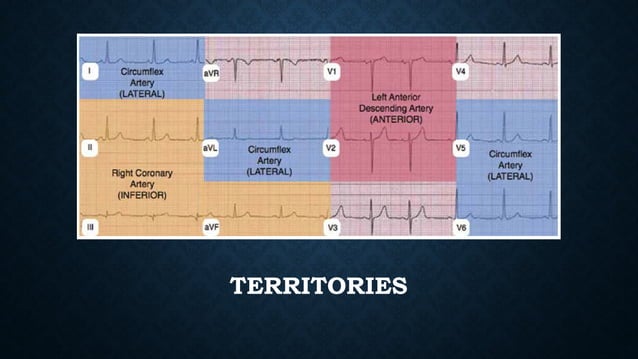 ECG Made Easy - Refresh your ECG Interpretation Skills | PPTX