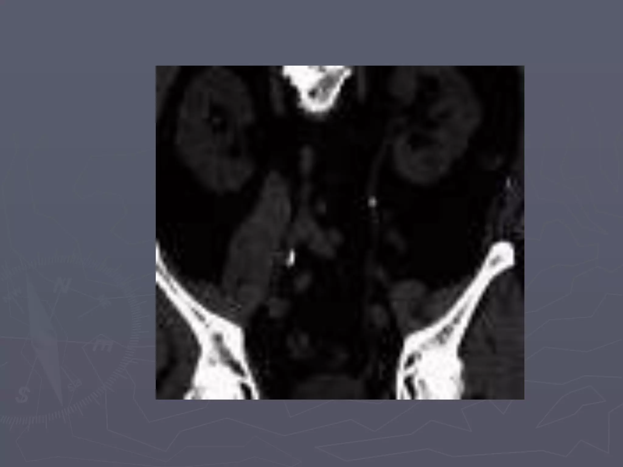 Genitourinary System.ppt