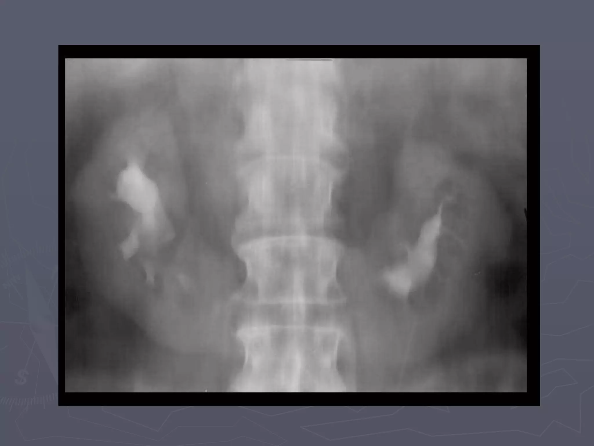 Genitourinary System.ppt
