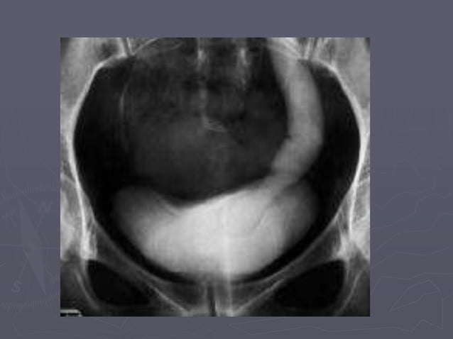 Genitourinary System.ppt