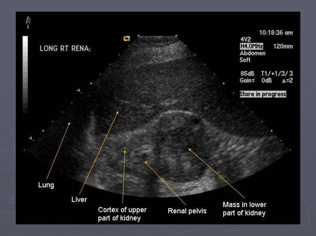 Genitourinary System.ppt