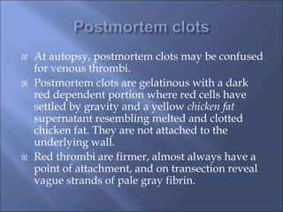 15-pathology of hemodynamicsHEMODYNAMIC DISORDERS.ppt