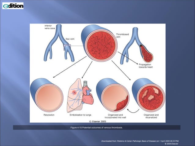 15-HEMODYNAMIC DISORDERS. physiology , blood flow regulation | PPT