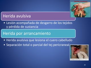 Heridas | PPTX