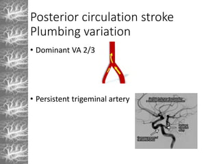15-Posterior-Circulation-Stroke - Neurologypdf | PDF