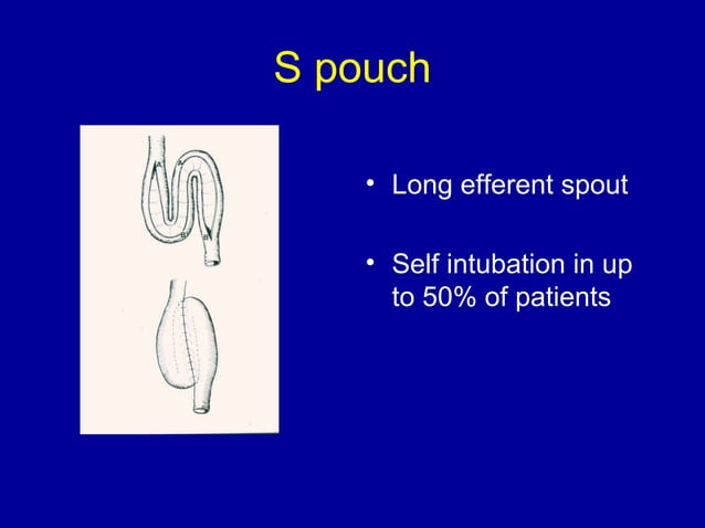 Surgical challenges of lap pouch surgery | PPT