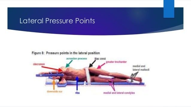 ANES 1502 - M12 PPT: Positioning (1 of 2)