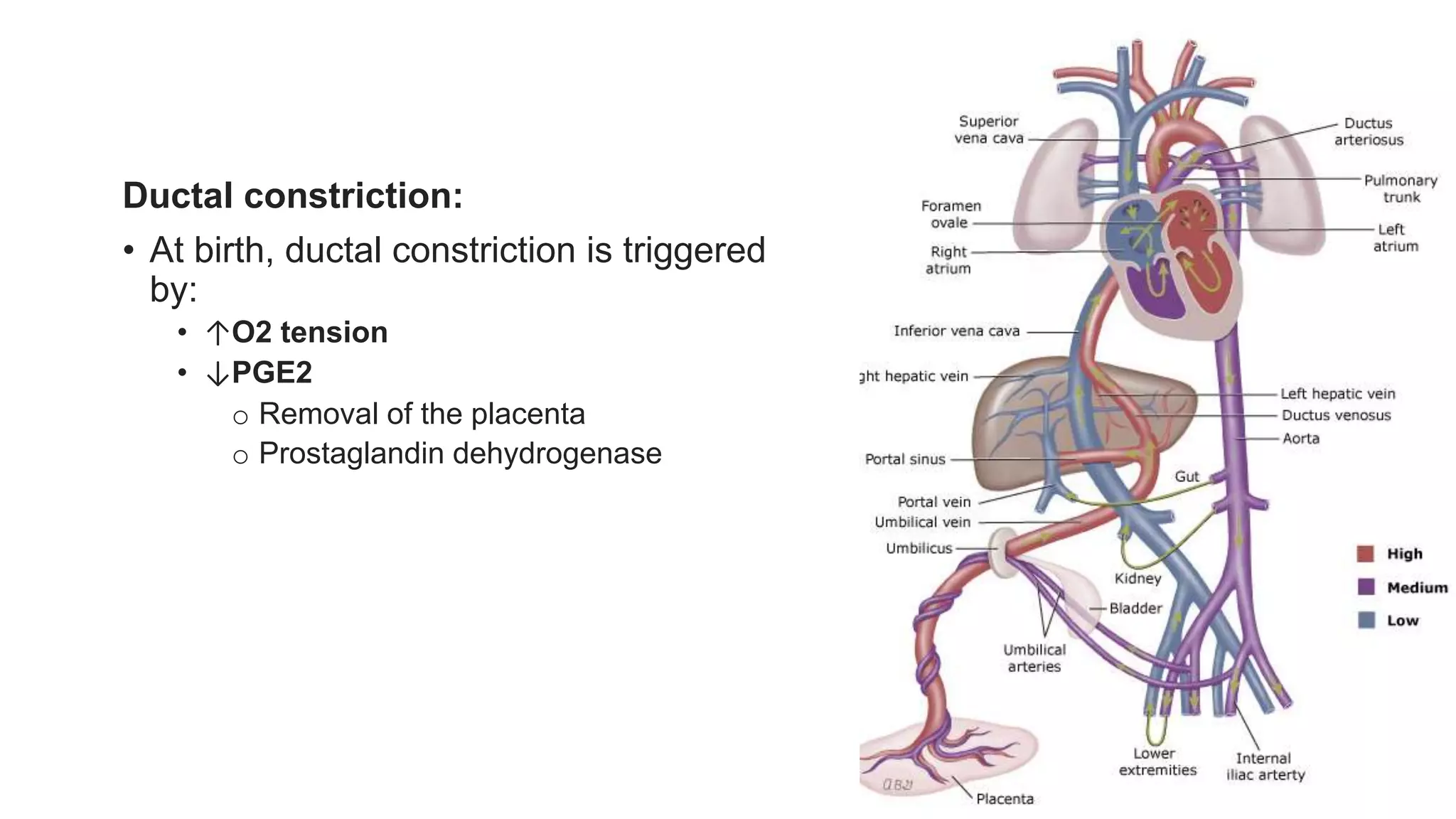 Patent Ductus Arteriosus (PDA) Echocardiographic Assessment: Anatomy ...