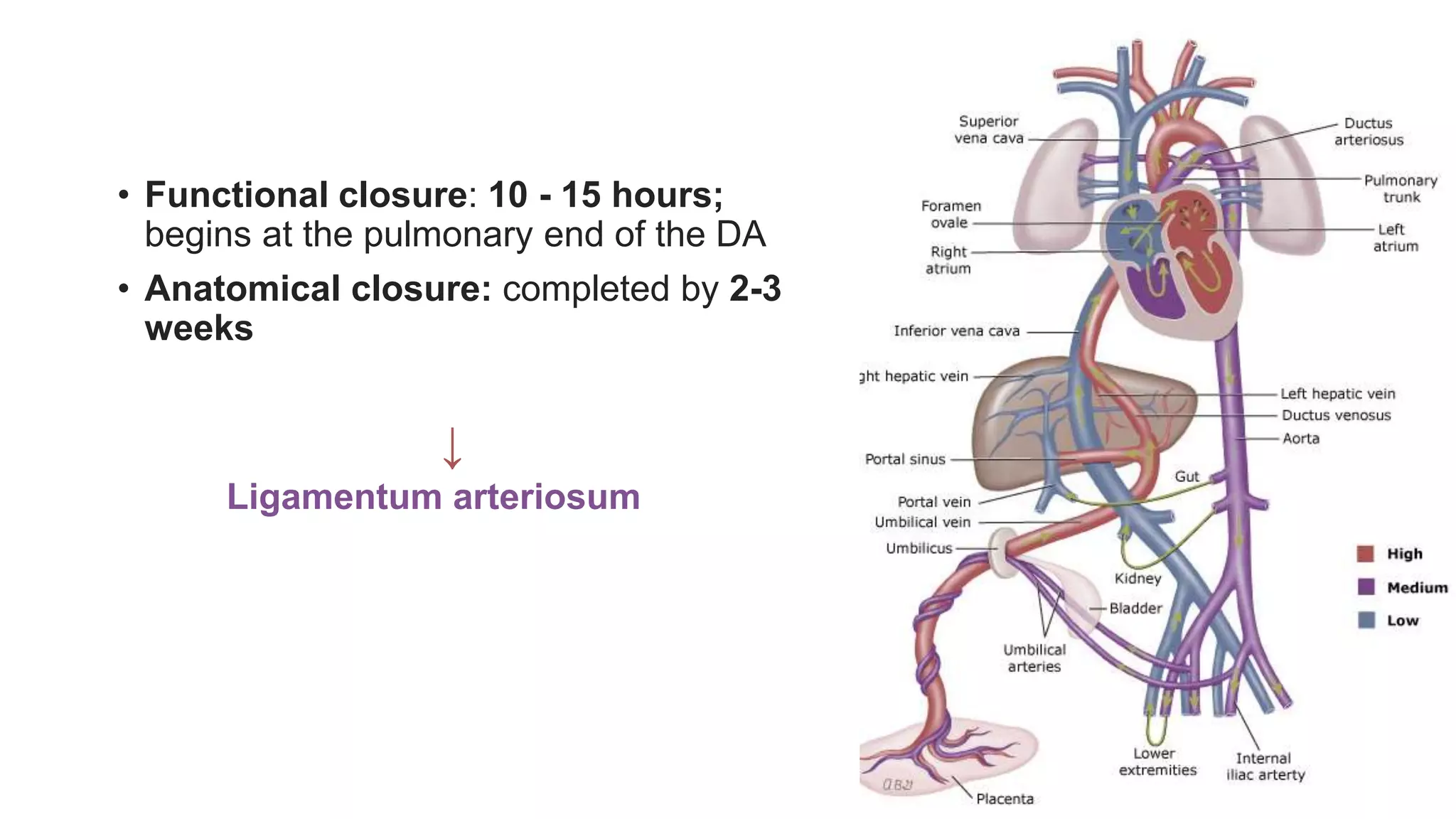 Patent Ductus Arteriosus (PDA) Echocardiographic Assessment: Anatomy ...