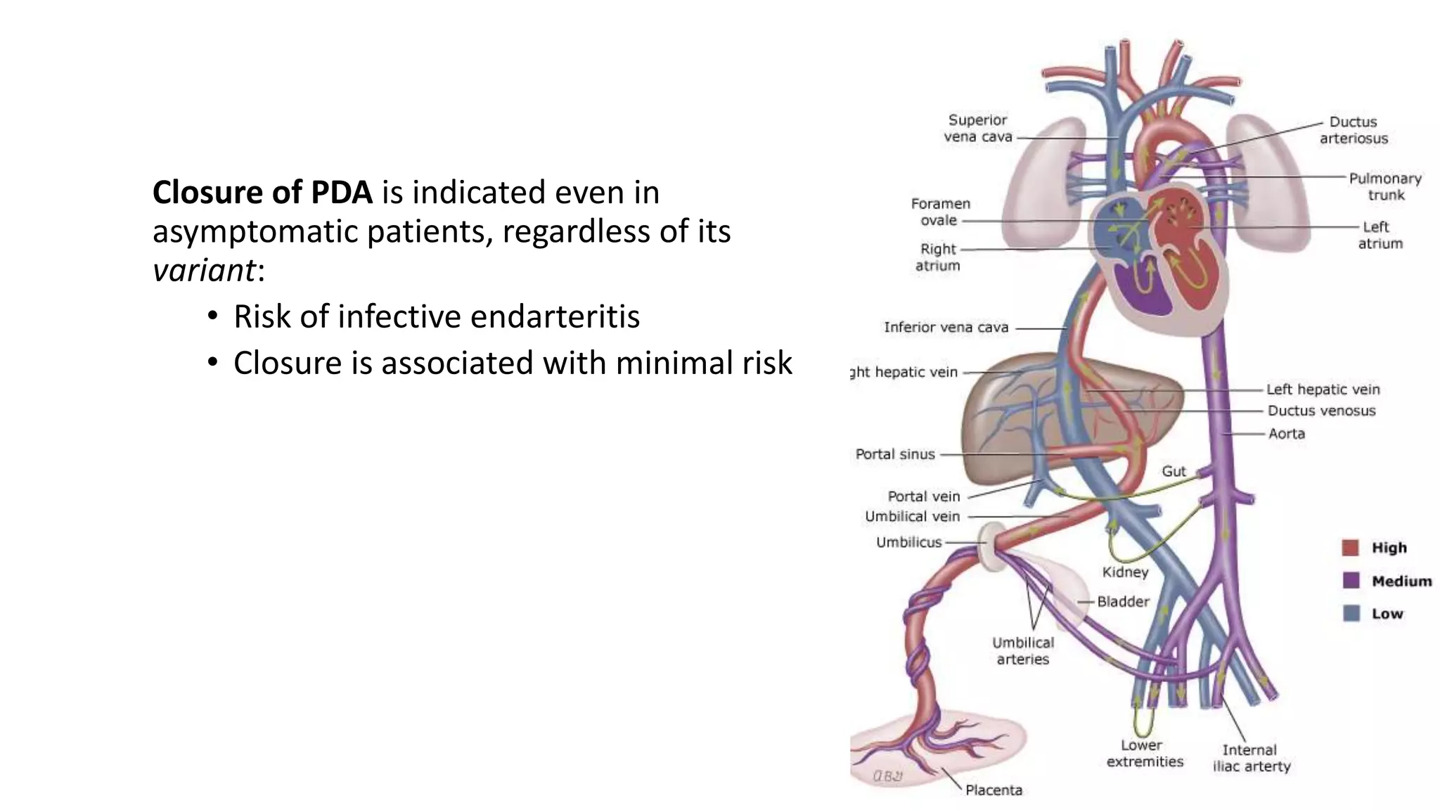 Patent Ductus Arteriosus (PDA) Echocardiographic Assessment: Anatomy ...