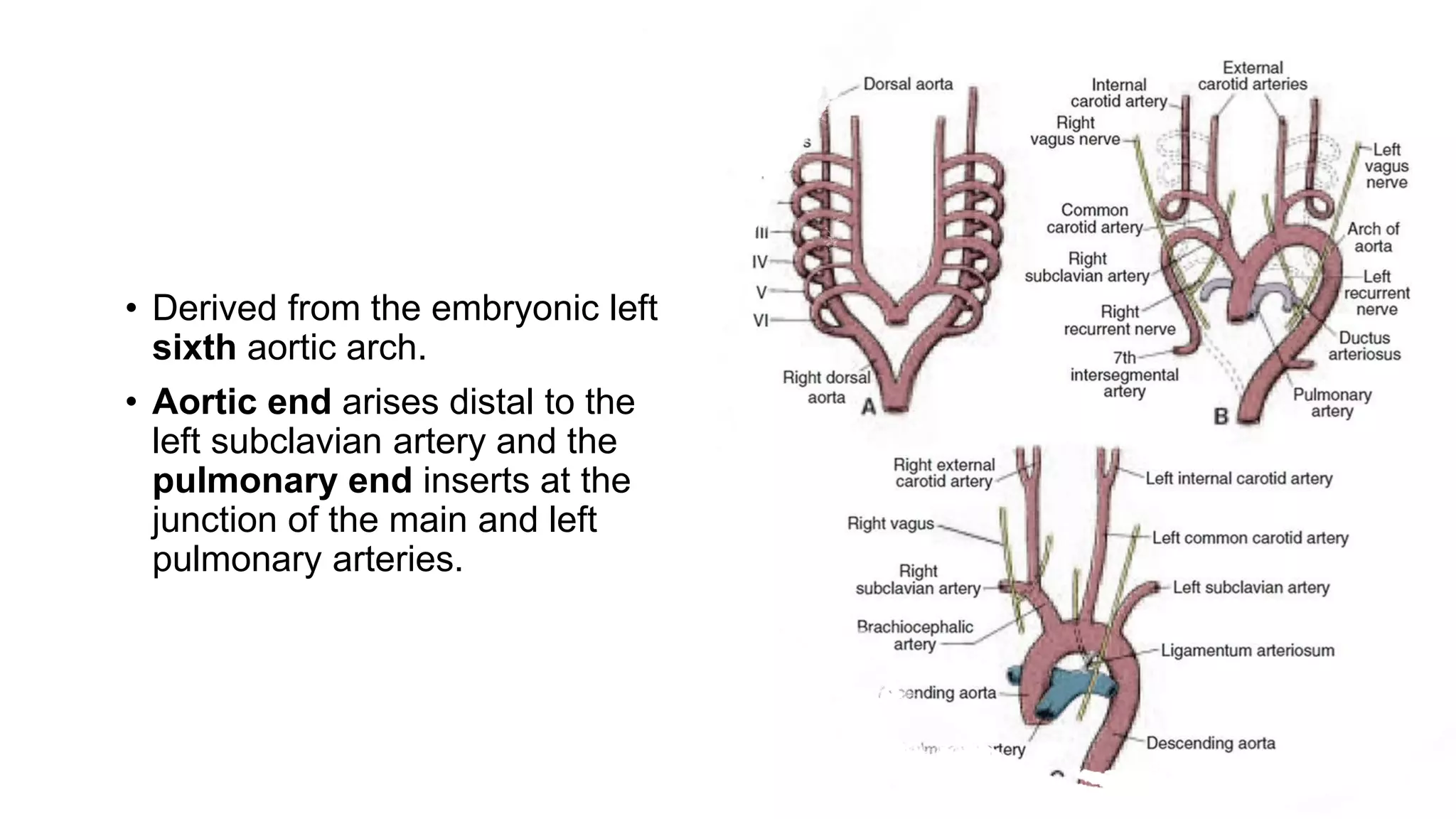 Patent Ductus Arteriosus (PDA) Echocardiographic Assessment: Anatomy ...