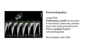 Patent Ductus Arteriosus (PDA) Echocardiographic Assessment: Anatomy ...