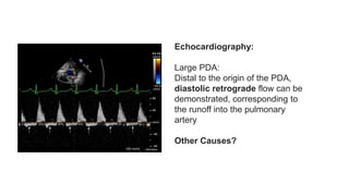 Patent Ductus Arteriosus (PDA) Echocardiographic Assessment: Anatomy ...