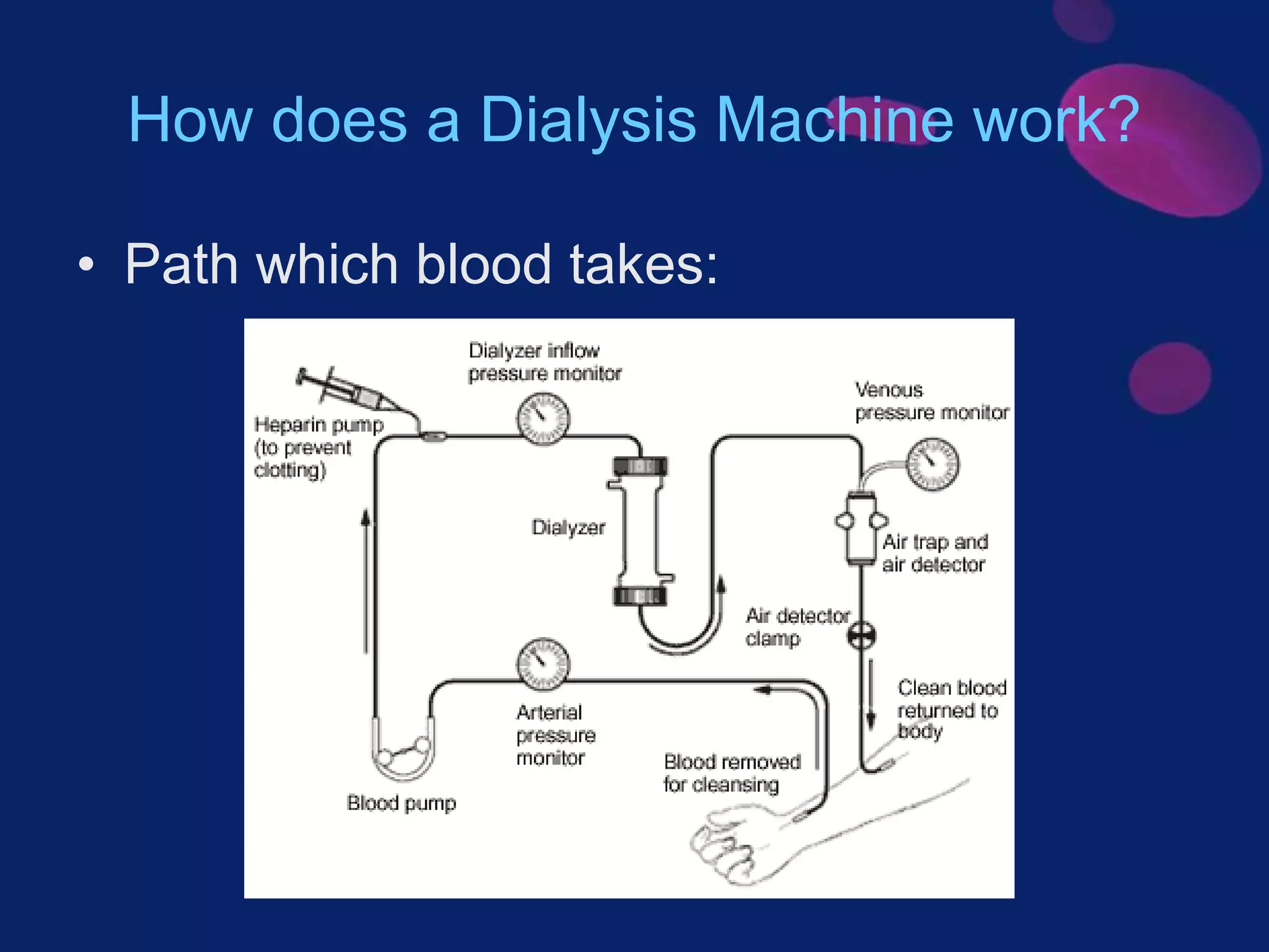150690211-Dialysis.ppt