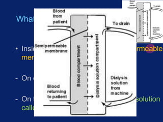 150690211-Dialysis.ppt
